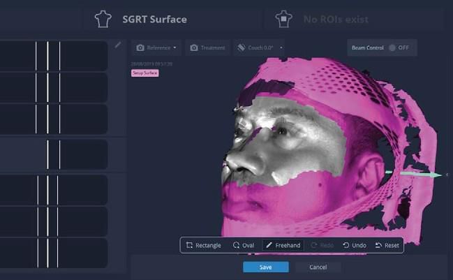 AlignRT | 放射線治療装置 輸入販売・サポート|ユーロメディテック株式会社