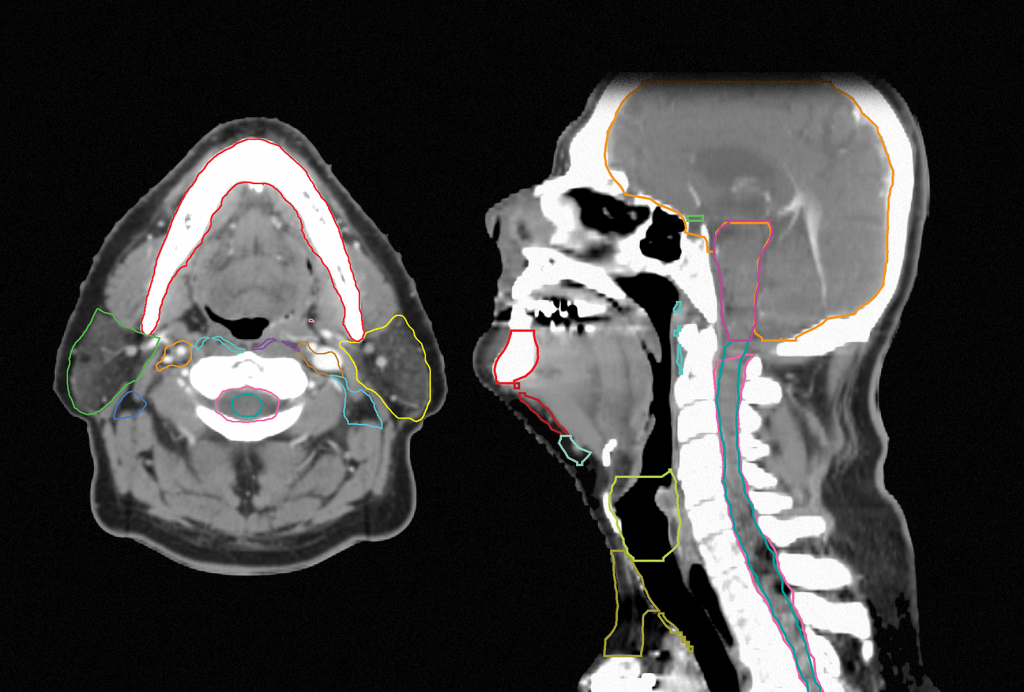 MIM Maestro | 放射線治療装置 輸入販売・サポート|ユーロメディテック株式会社