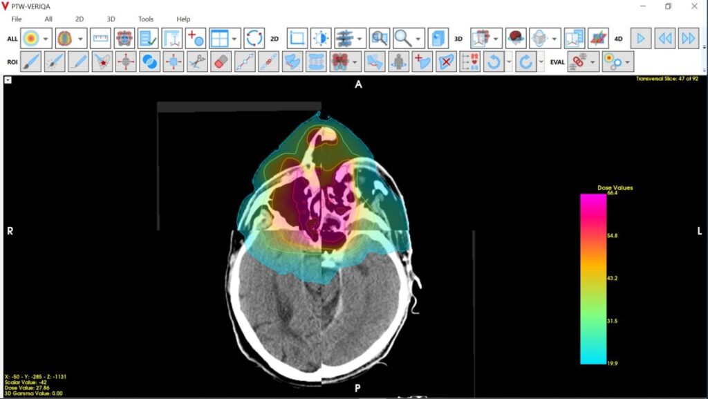 VERIQA RT Evaluate | 放射線治療装置 輸入販売・サポート|ユーロメディテック株式会社
